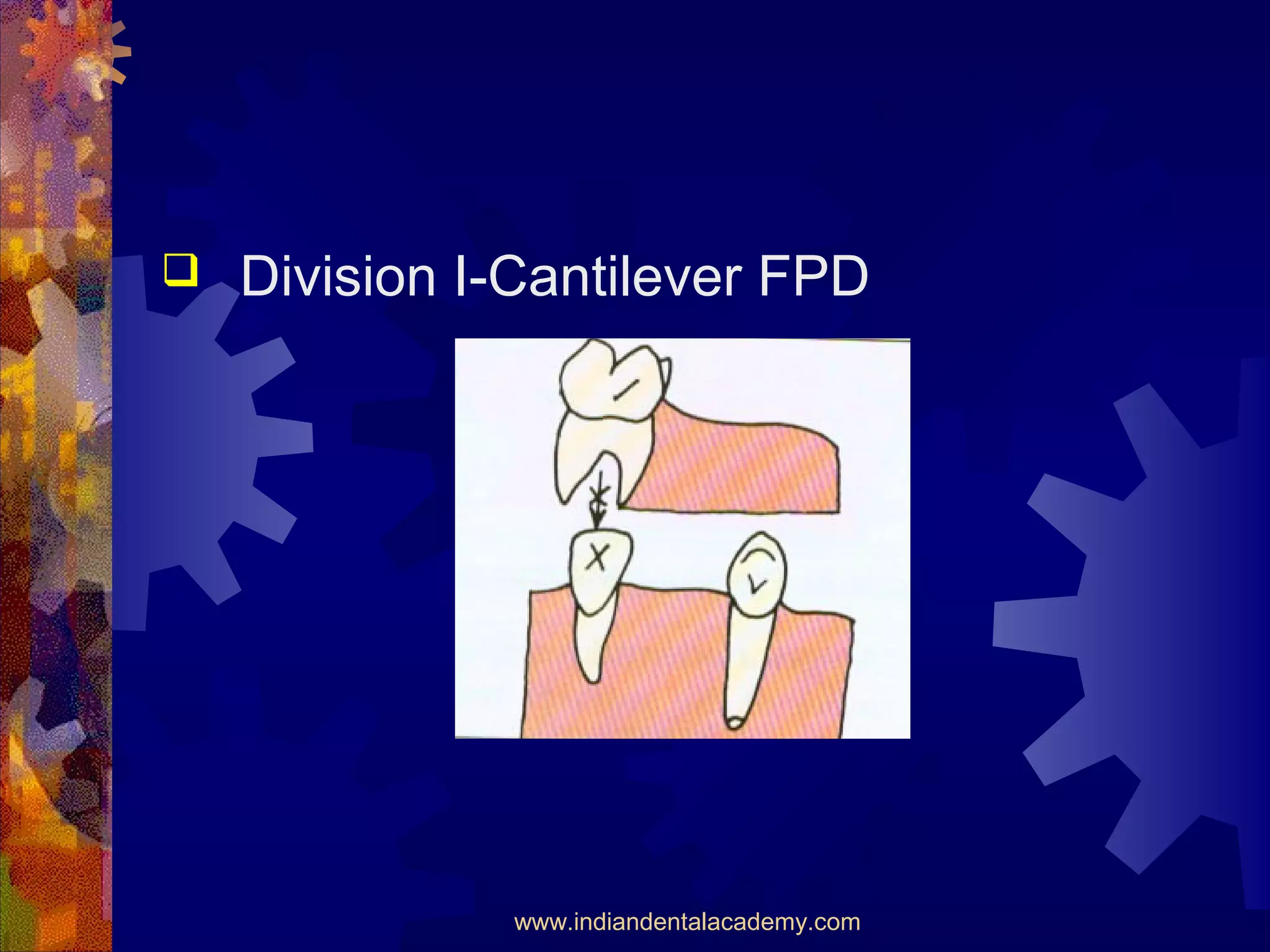 Classification and configuration for fpd/dental courses | PPT