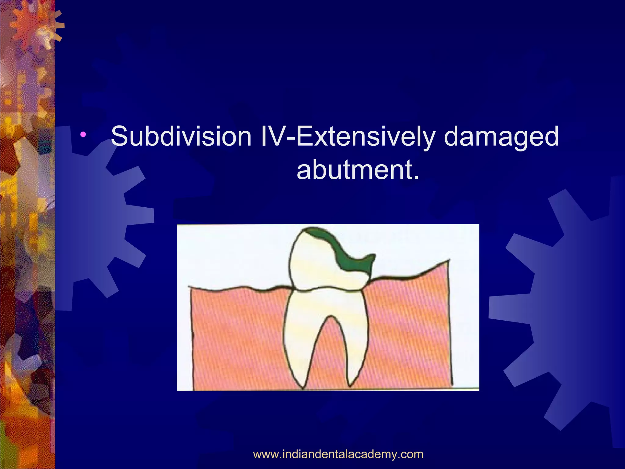 Classification and configuration for fpd/dental courses | PPT