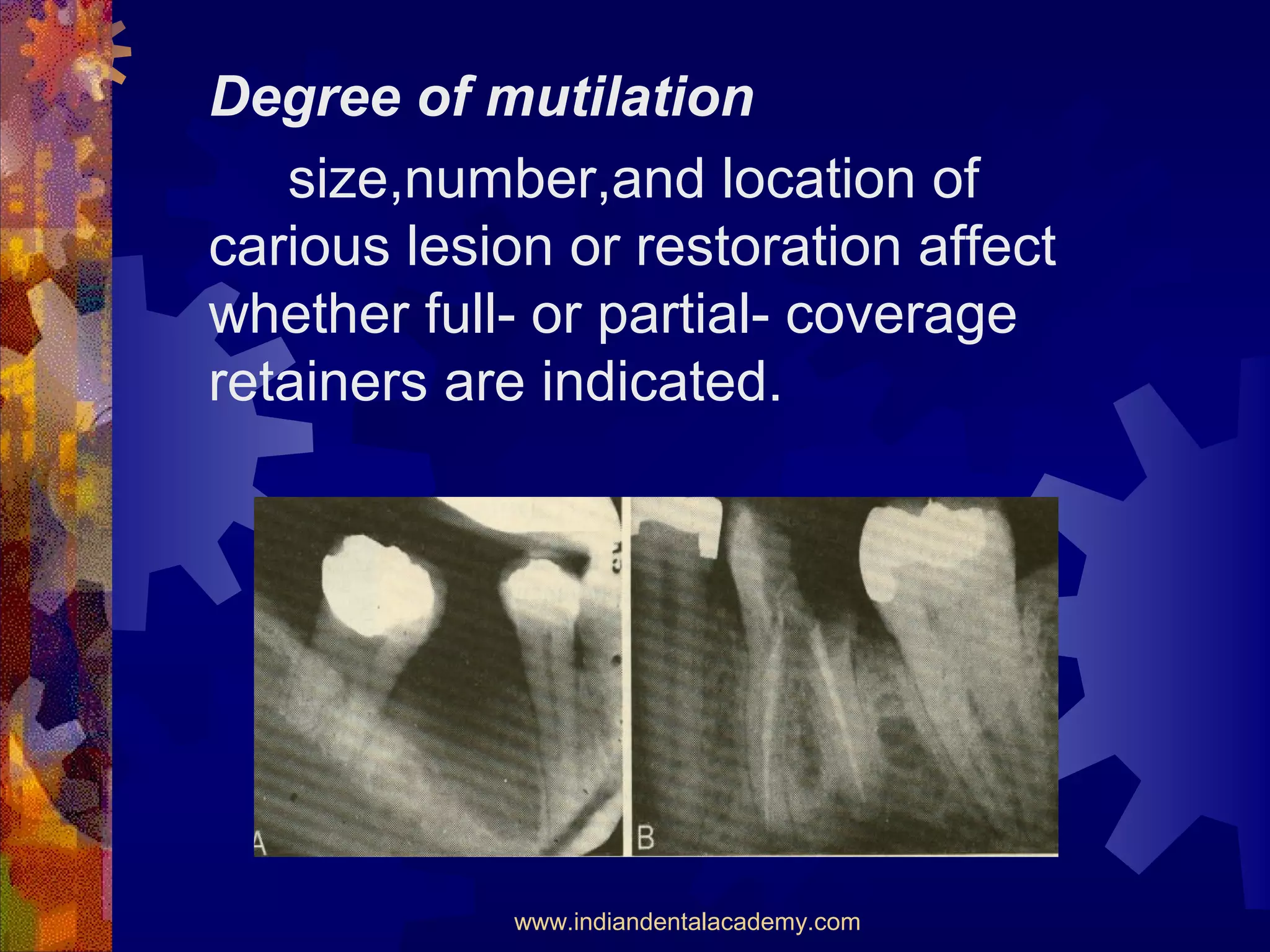 Classification and configuration for fpd/dental courses | PPT
