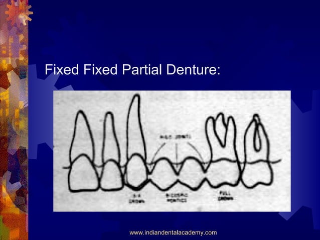 Classification and configuration for fpd/dental courses | PPT