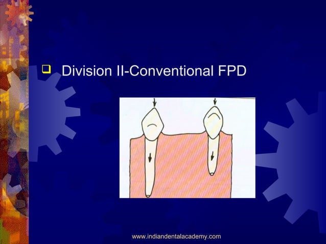 Classification and configuration for fpd/dental courses | PPT