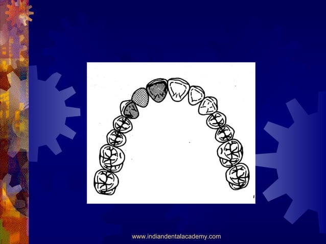 Classification and configuration for fpd/dental courses | PPT