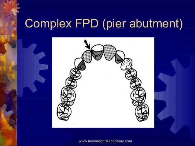 Classification and configuration for fpd/dental courses