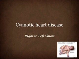 Classification of Congential Heart Diseases and cyanotic heart disease ...