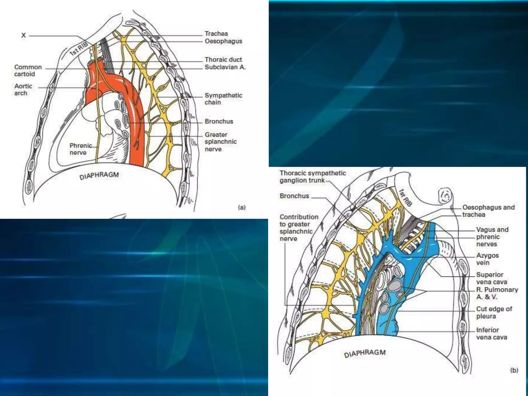 Classification and diagnostic approach to fnac of mediastinal | PPTX