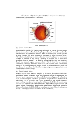 Classification and Evaluation of Macular Edema, Glaucoma and Alzheimer ...