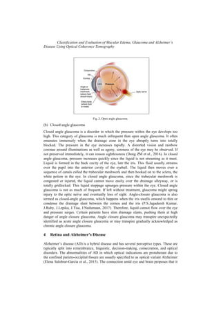 Classification and Evaluation of Macular Edema, Glaucoma and Alzheimer ...