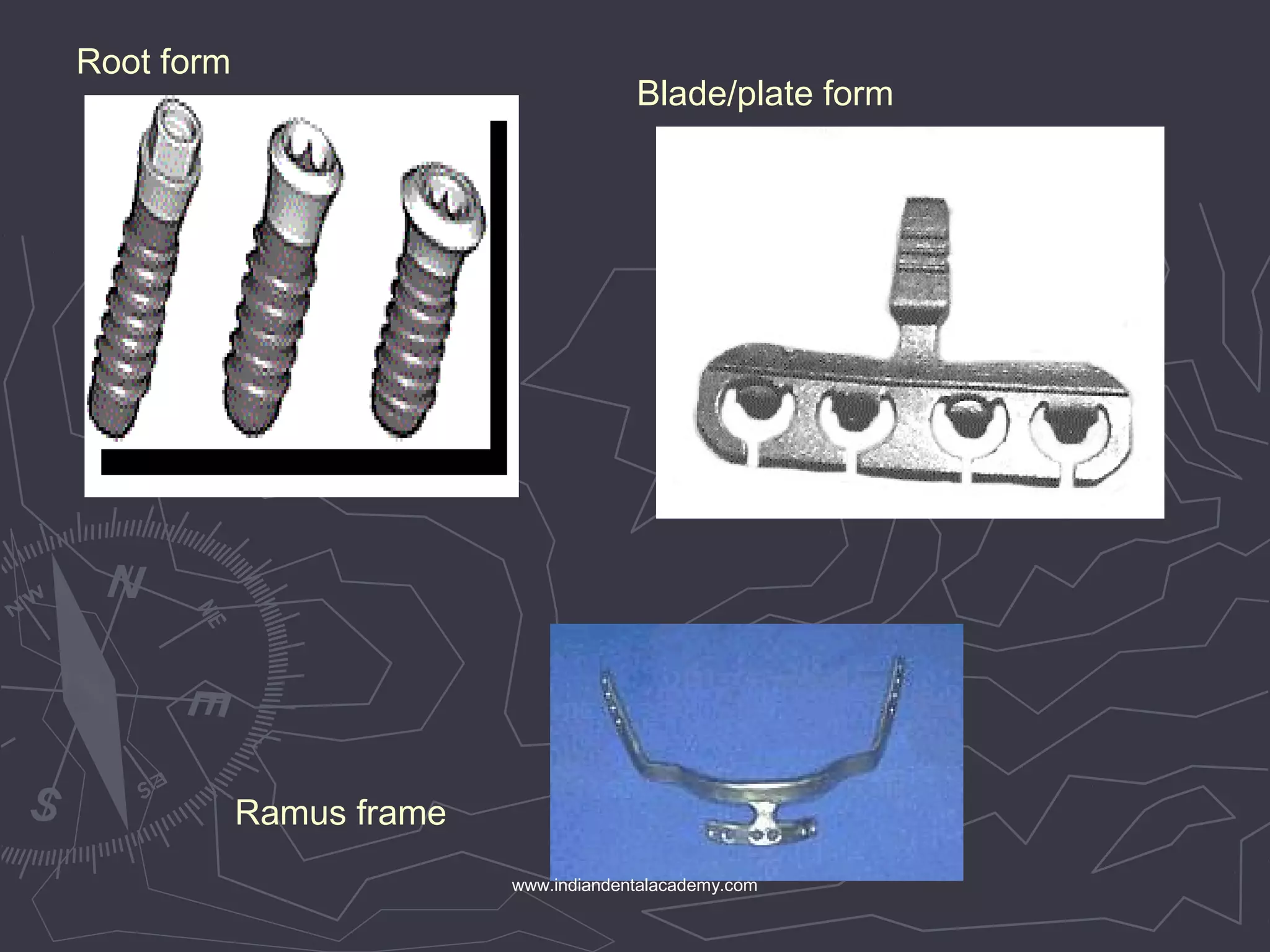 Classification and impression techniques of implants/ dentistry dental ...
