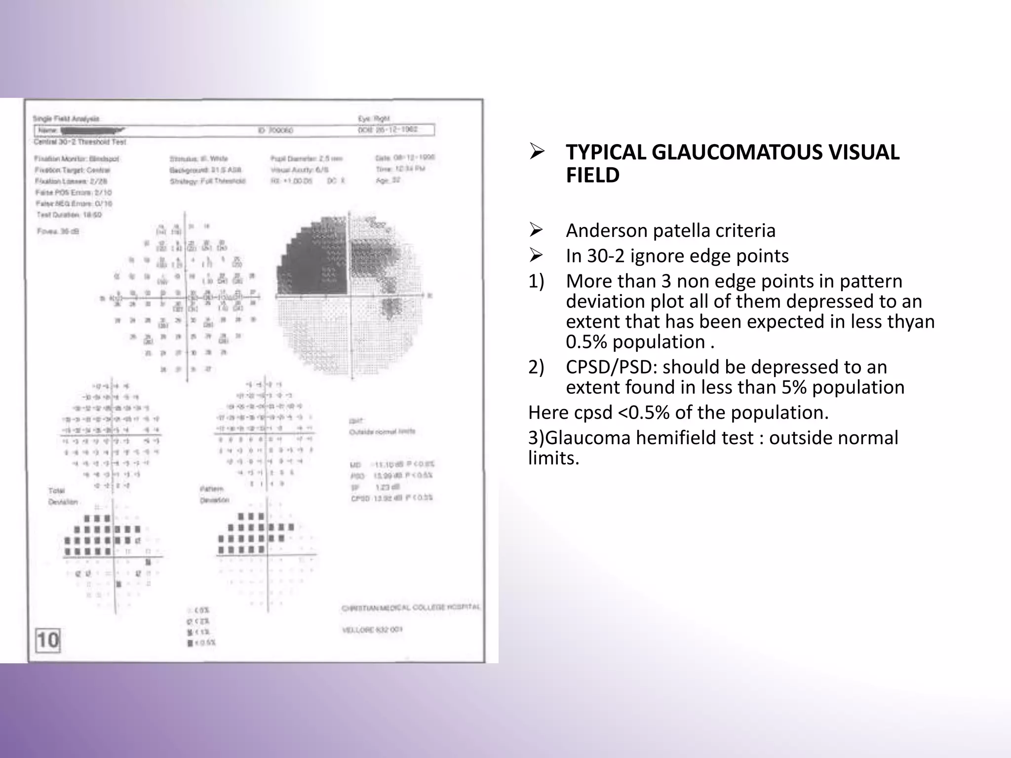 classification and management of glaucoma.pptx