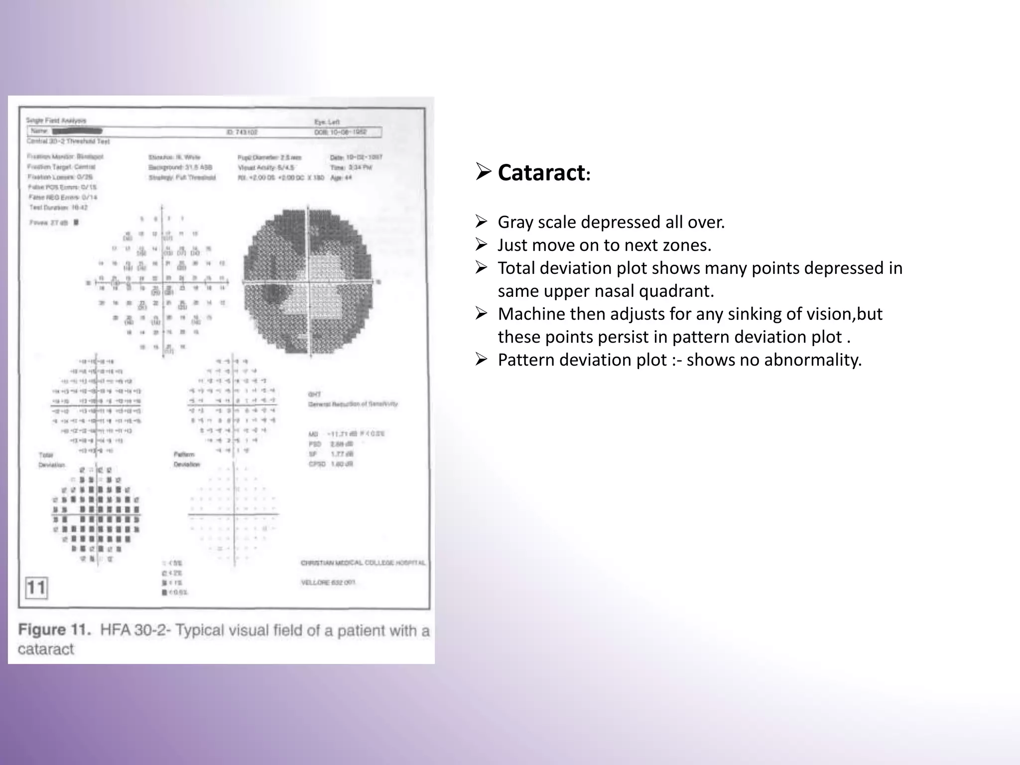 classification and management of glaucoma.pptx