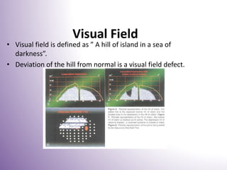 classification and management of glaucoma.pptx