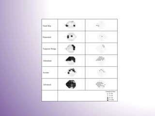 classification and management of glaucoma.pptx