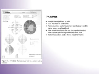 classification and management of glaucoma.pptx