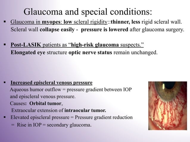 classification and management of glaucoma.pptx