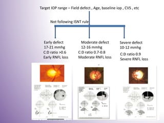classification and management of glaucoma.pptx