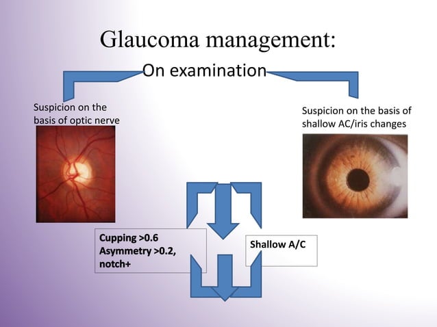 classification and management of glaucoma.pptx