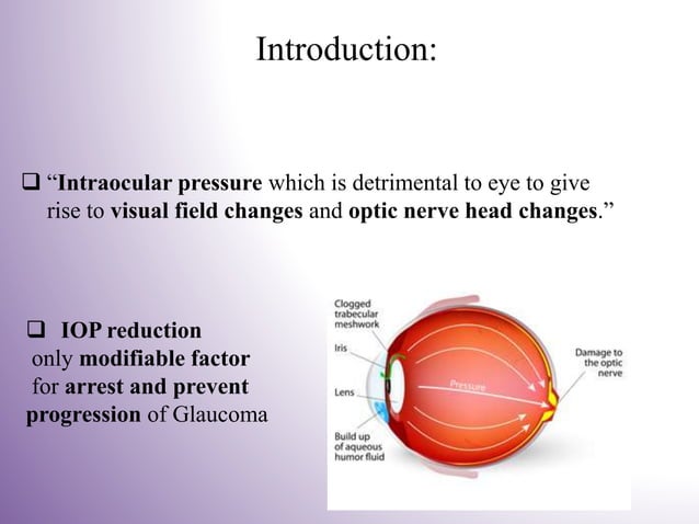 classification and management of glaucoma.pptx