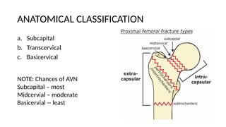 CLASSIFICATION AND MANAGEMENT OF NOF FRACTURE-1.pptx