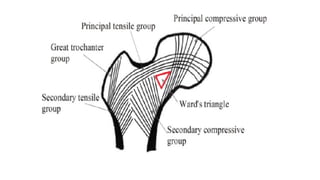 CLASSIFICATION AND MANAGEMENT OF NOF FRACTURE-1.pptx