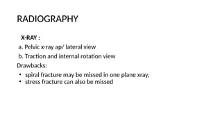 CLASSIFICATION AND MANAGEMENT OF NOF FRACTURE-1.pptx