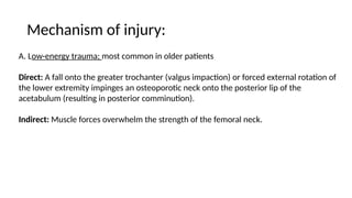CLASSIFICATION AND MANAGEMENT OF NOF FRACTURE-1.pptx
