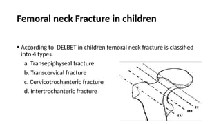 CLASSIFICATION AND MANAGEMENT OF NOF FRACTURE-1.pptx
