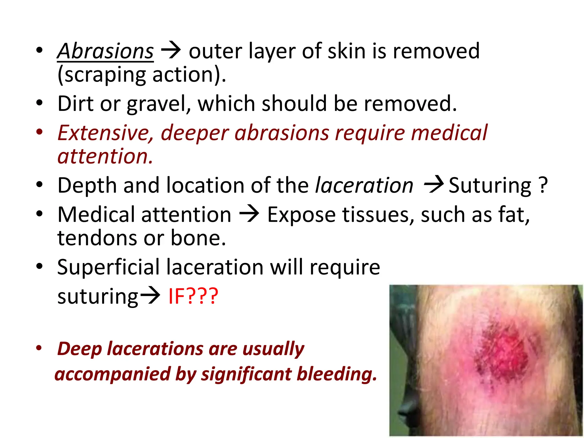 Classification and Management of Sports Injuries.pptx