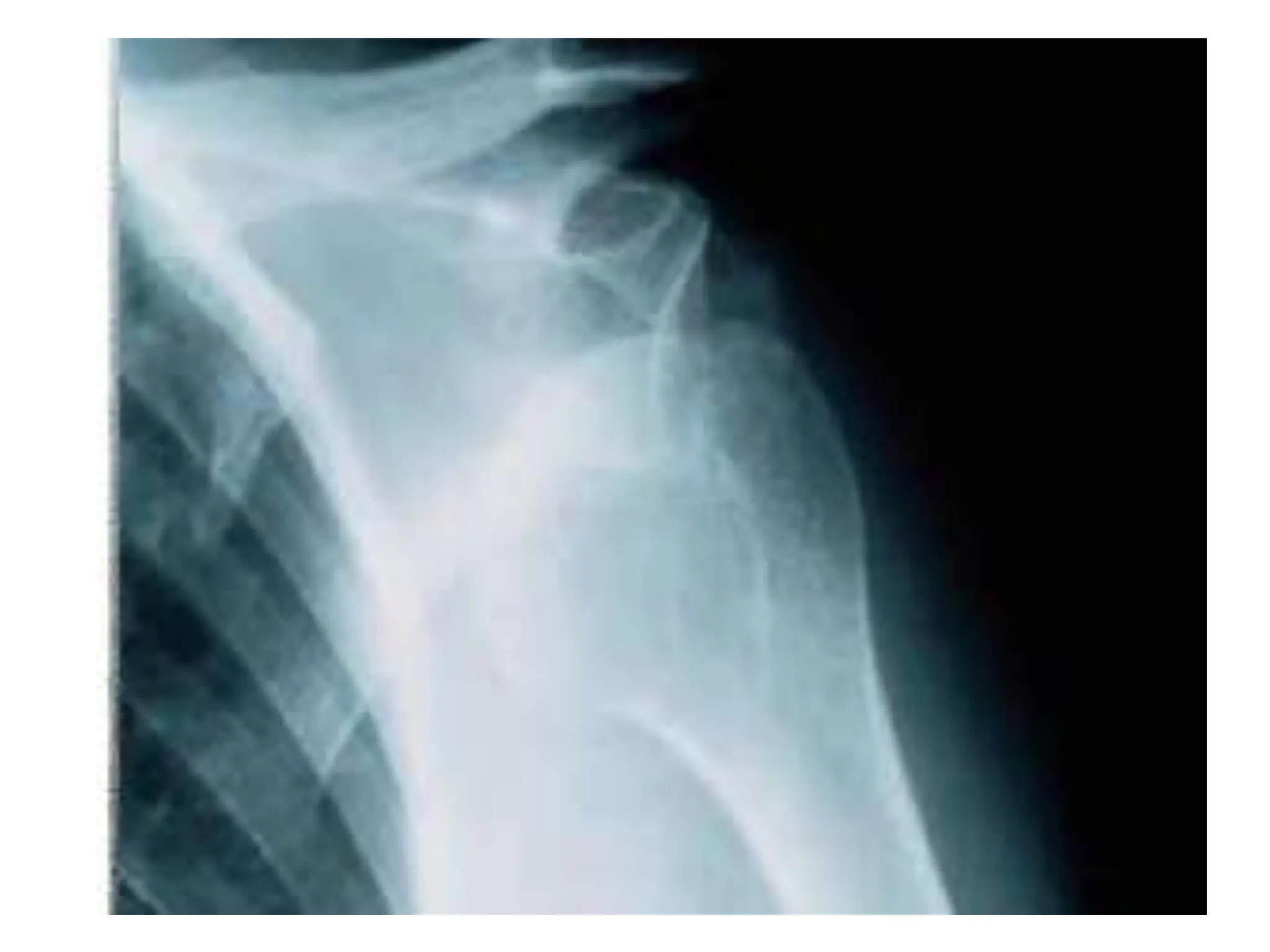 Classification and Management of Sports Injuries.pptx