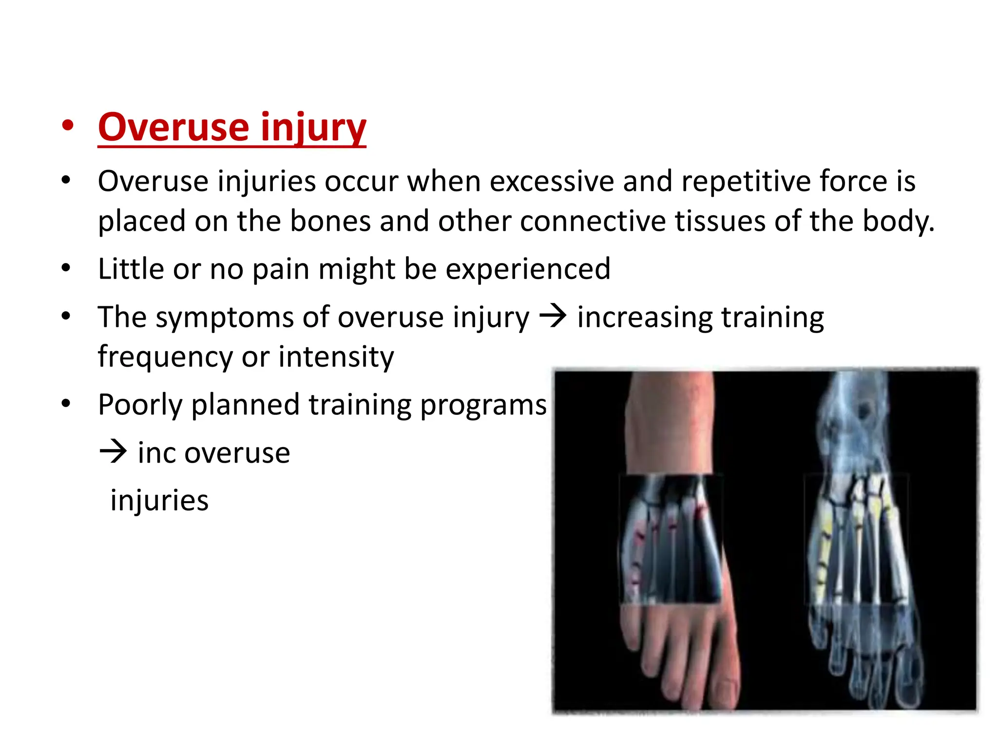 Classification and Management of Sports Injuries.pptx