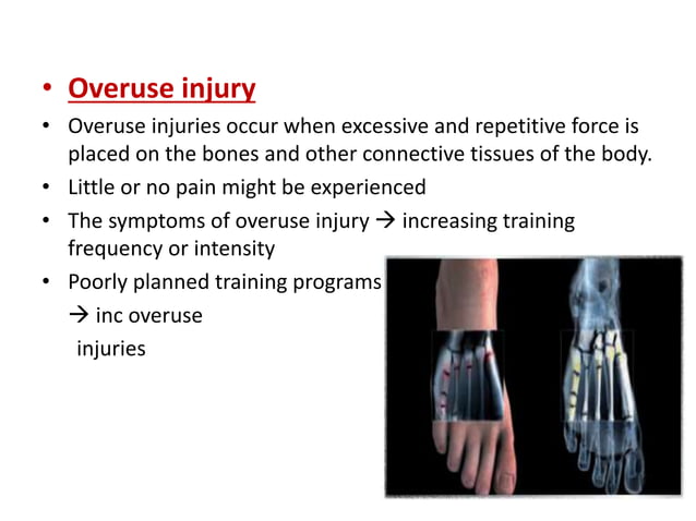 Classification and Management of Sports Injuries.pptx