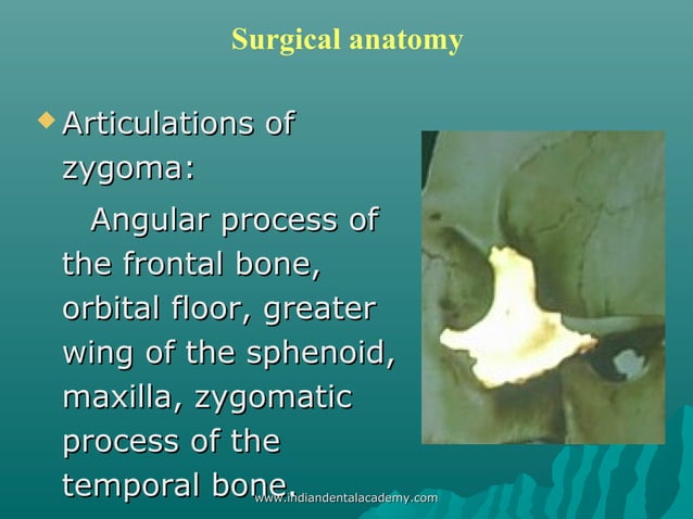Classification & management of zygomatic complex fractures including ...