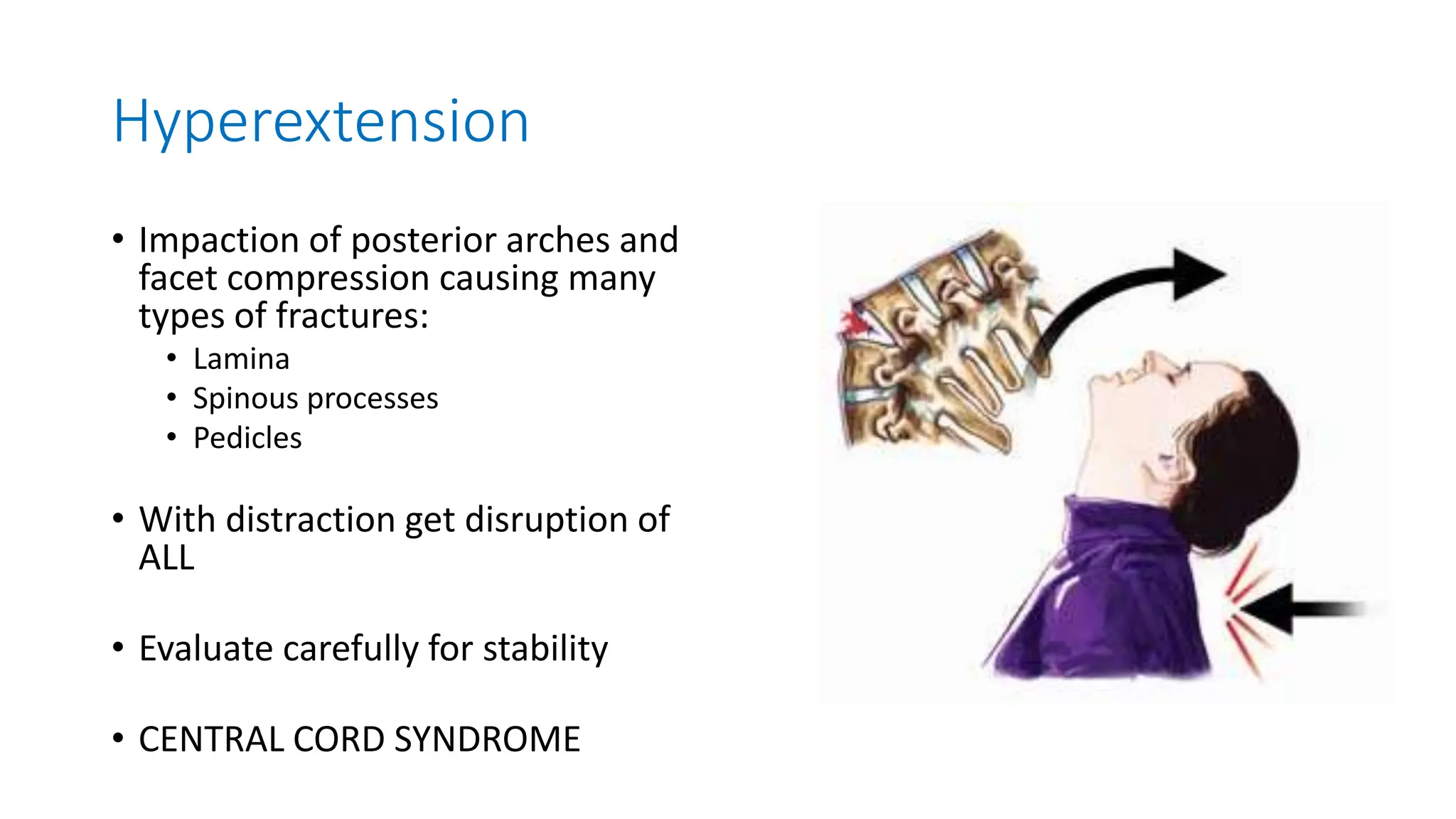 Classification and mechanism of subaxial cervical spine injuries.pptx