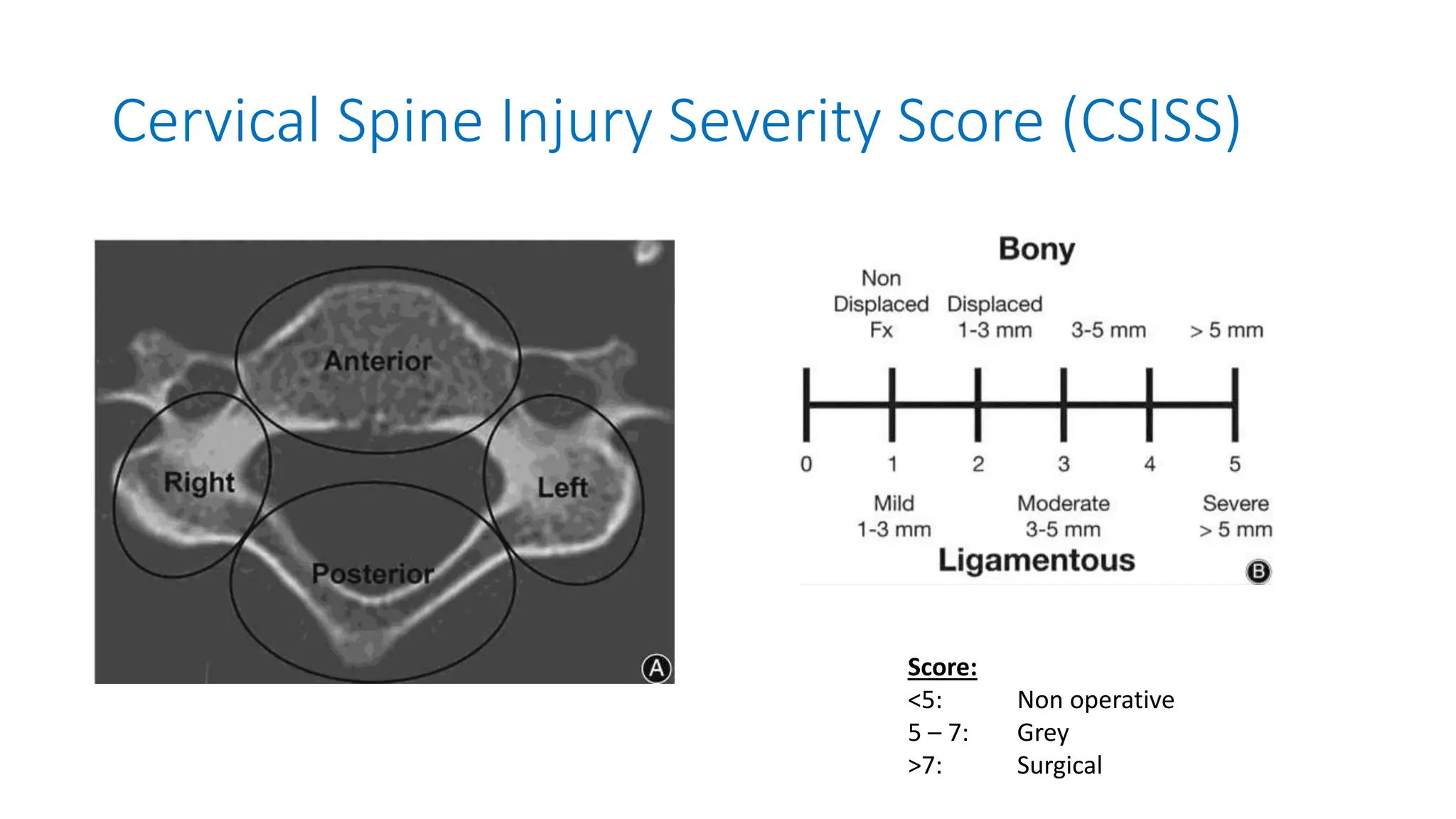 Classification and mechanism of subaxial cervical spine injuries.pptx