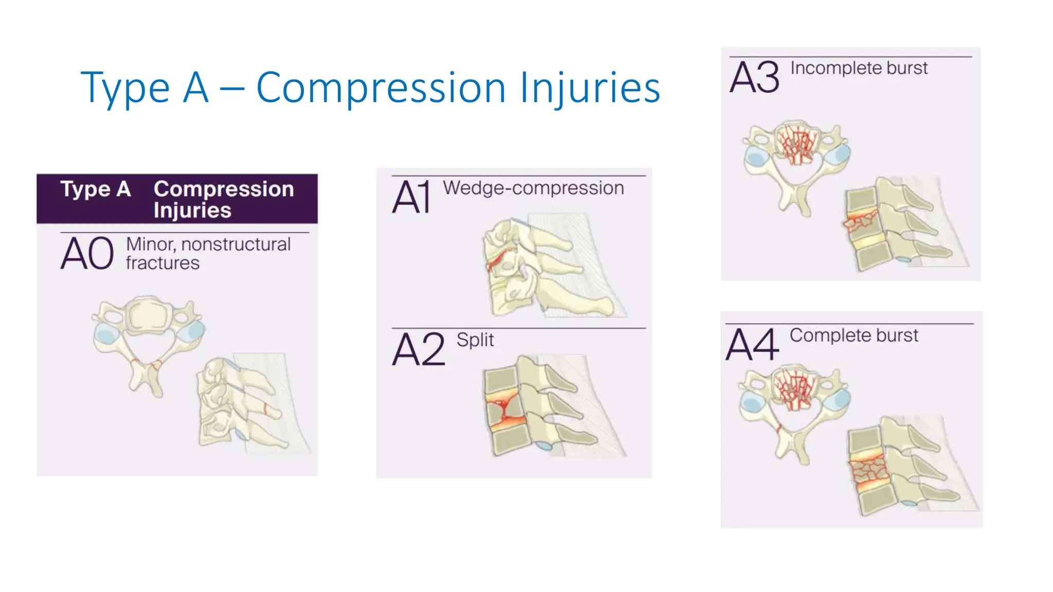 Classification and mechanism of subaxial cervical spine injuries.pptx