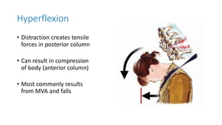 Classification and mechanism of subaxial cervical spine injuries.pptx