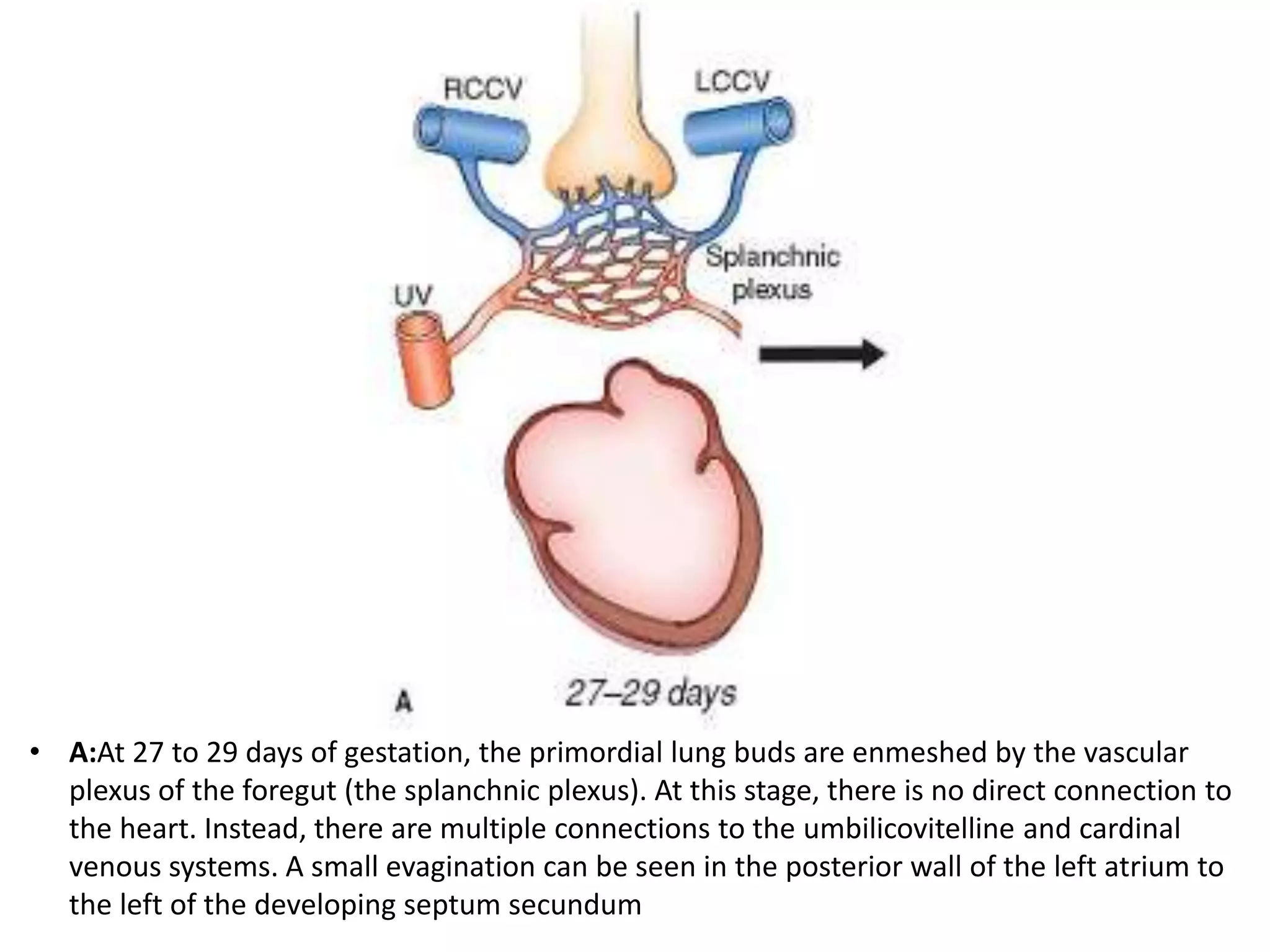 Classification and pathophysiology of tapvc | PPTX