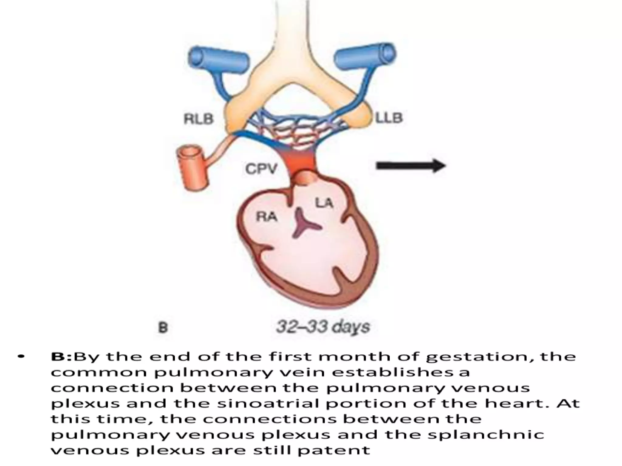 Classification and pathophysiology of tapvc | PPTX