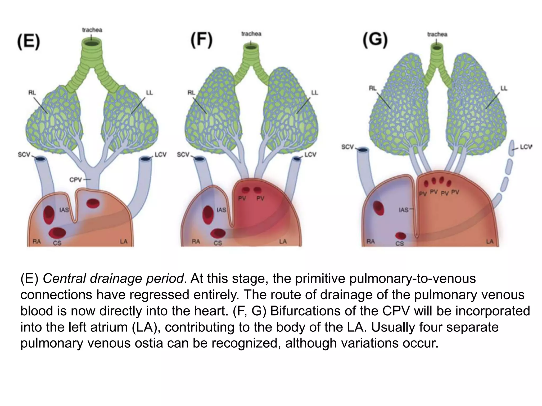 Classification and pathophysiology of tapvc | PPTX