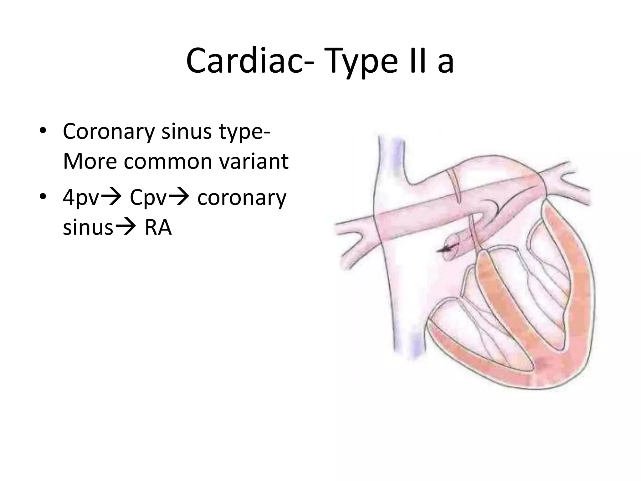 Classification and pathophysiology of tapvc | PPTX