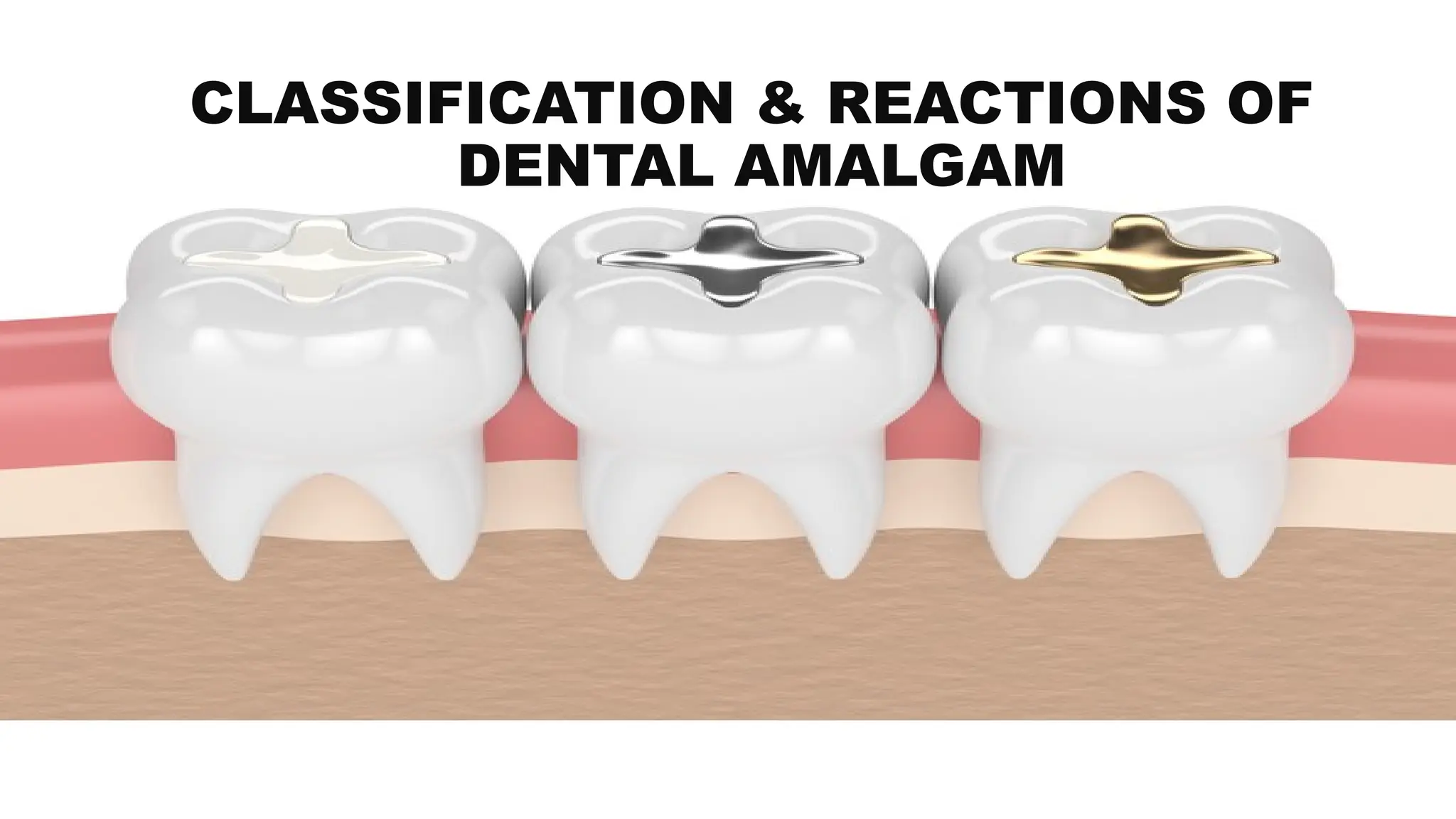 classification and reaction of dental amalgam diksha1.pptx