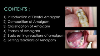 classification and reaction of dental amalgam diksha1.pptx
