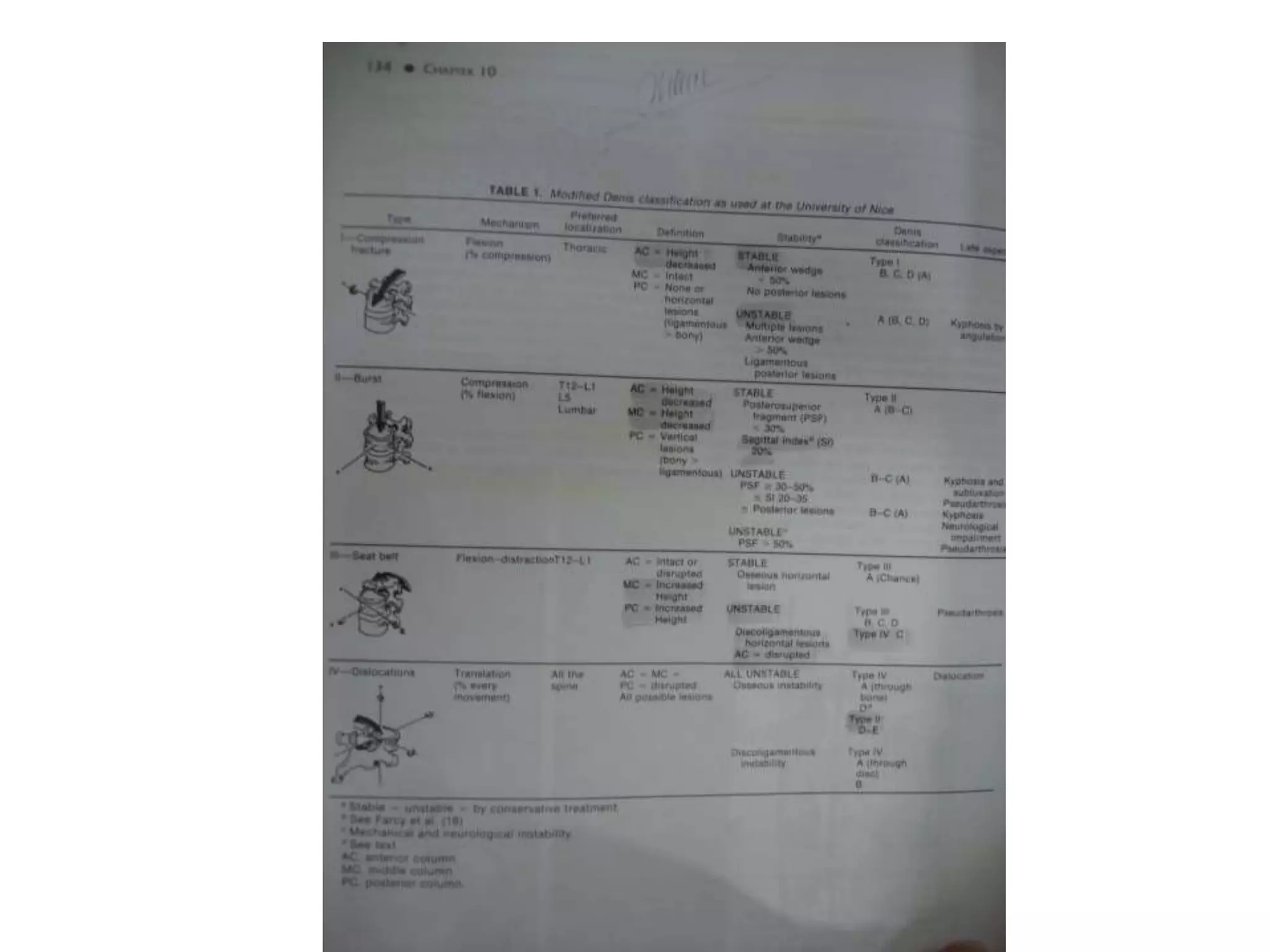 Classification and treament fracture of the spine | PPT