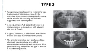 Classification and treatment plans for partially and completely ...