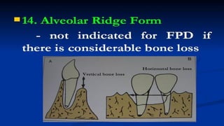 Classification and type of bridge (2).pdf