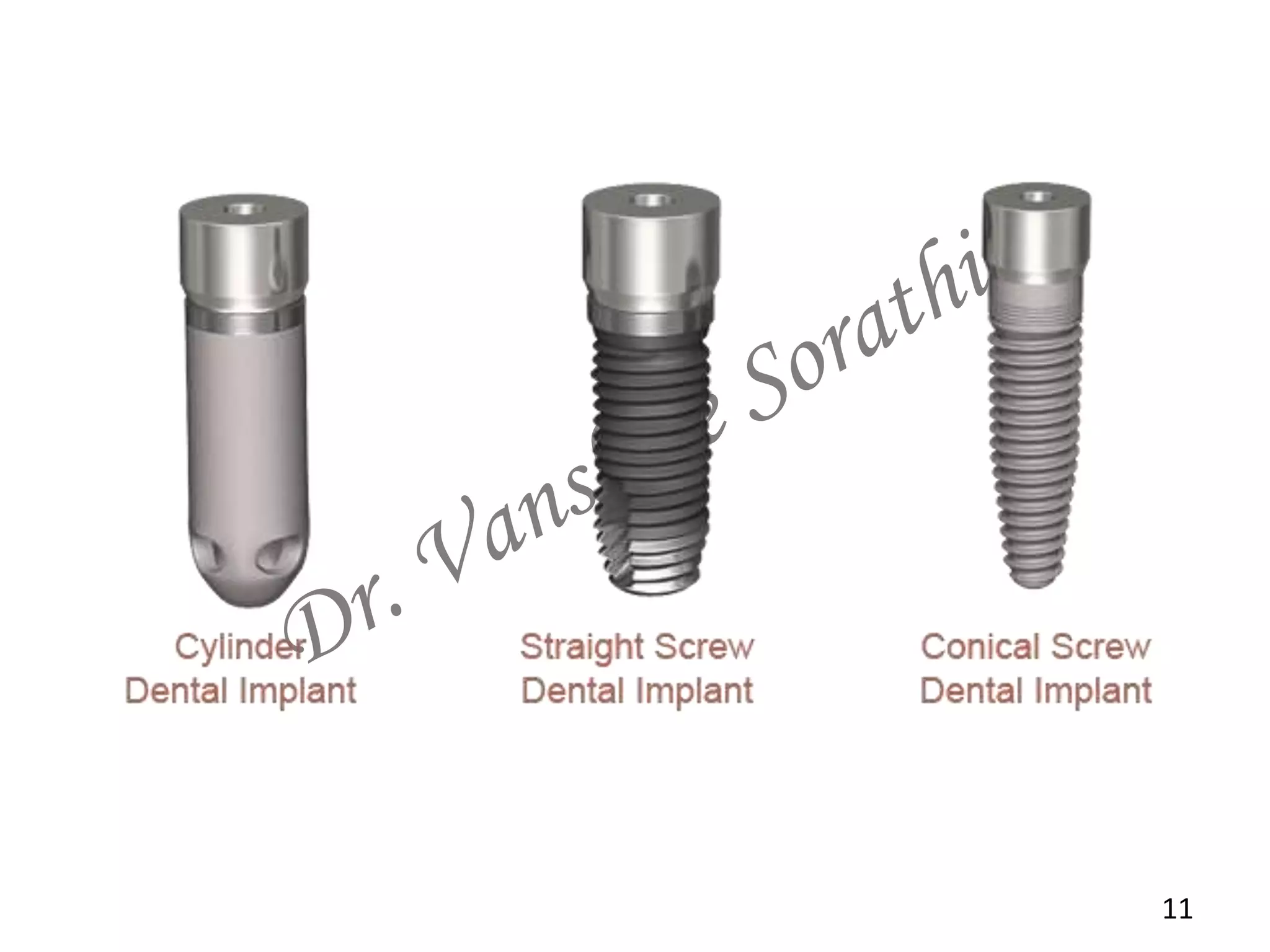 Classification and Types of Craniofacial Implants | PPTX