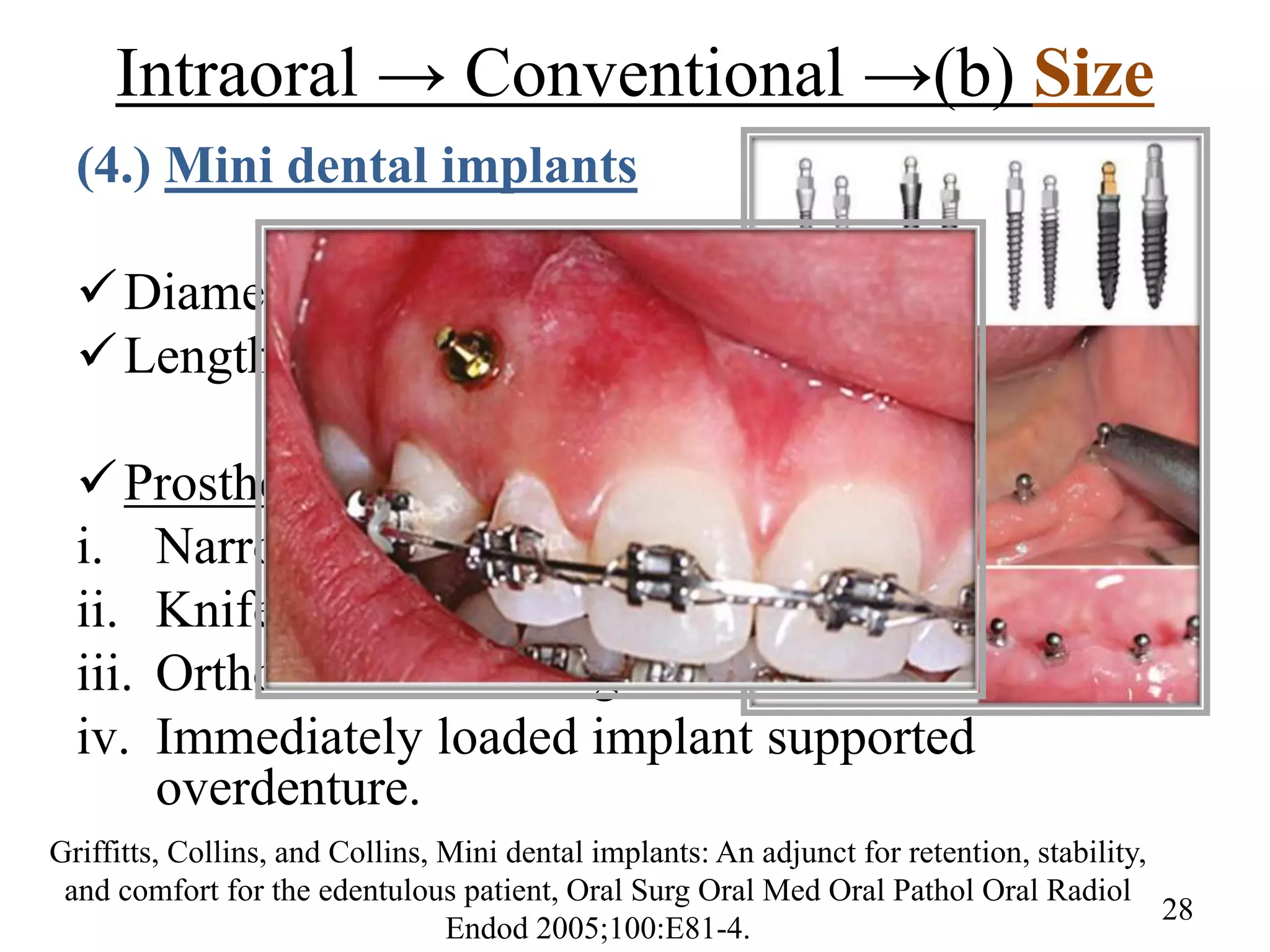 Classification and Types of Craniofacial Implants | PPTX