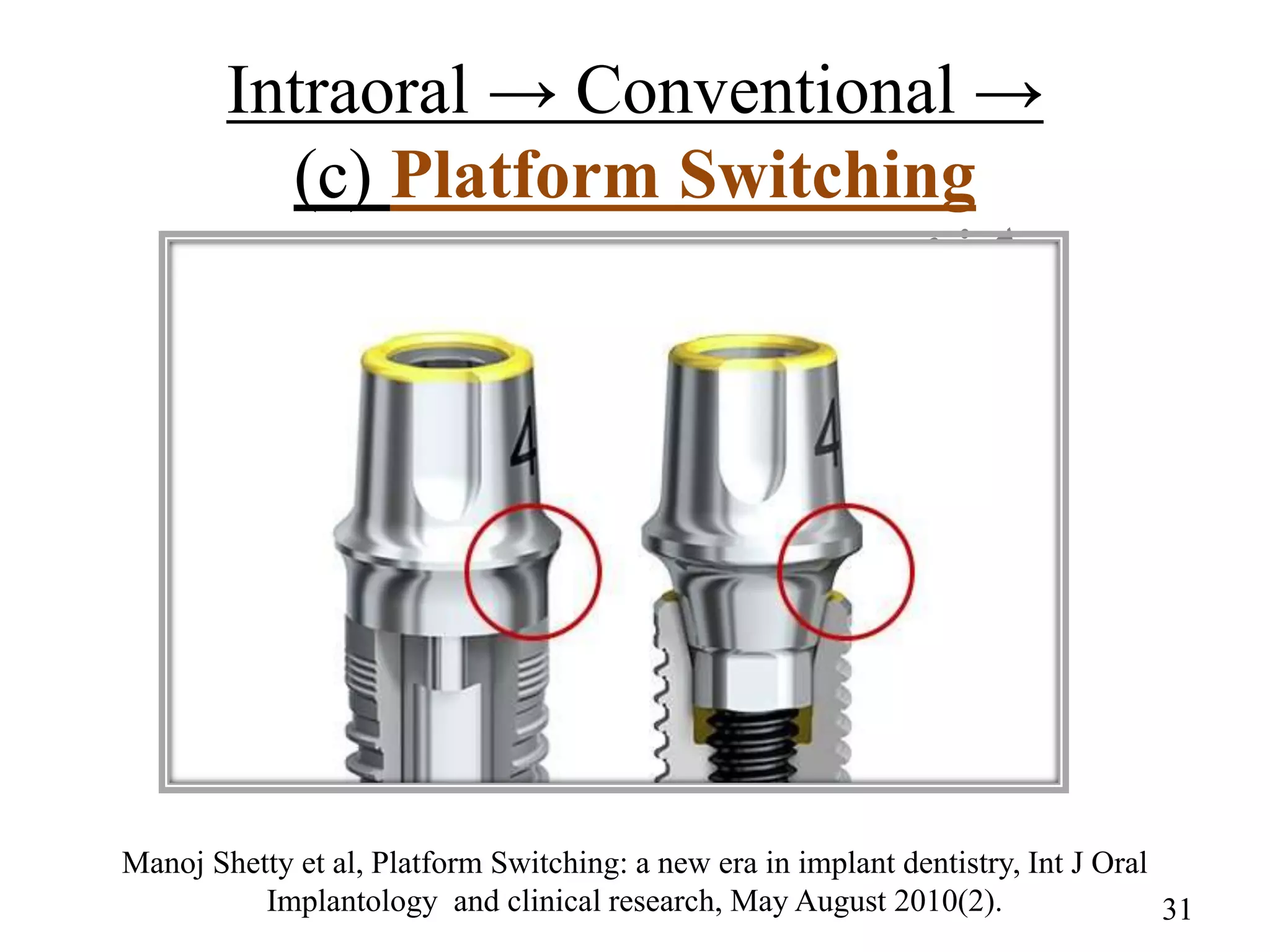 Classification and Types of Craniofacial Implants | PPTX | Oral care ...