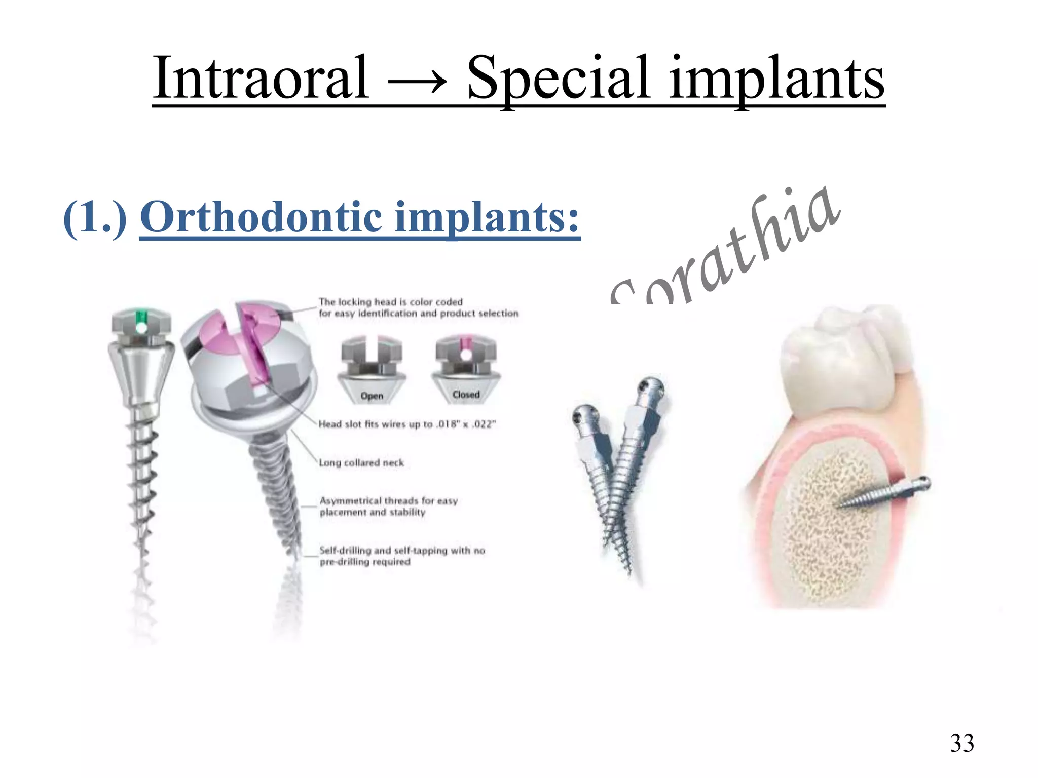 Classification and Types of Craniofacial Implants | PPTX