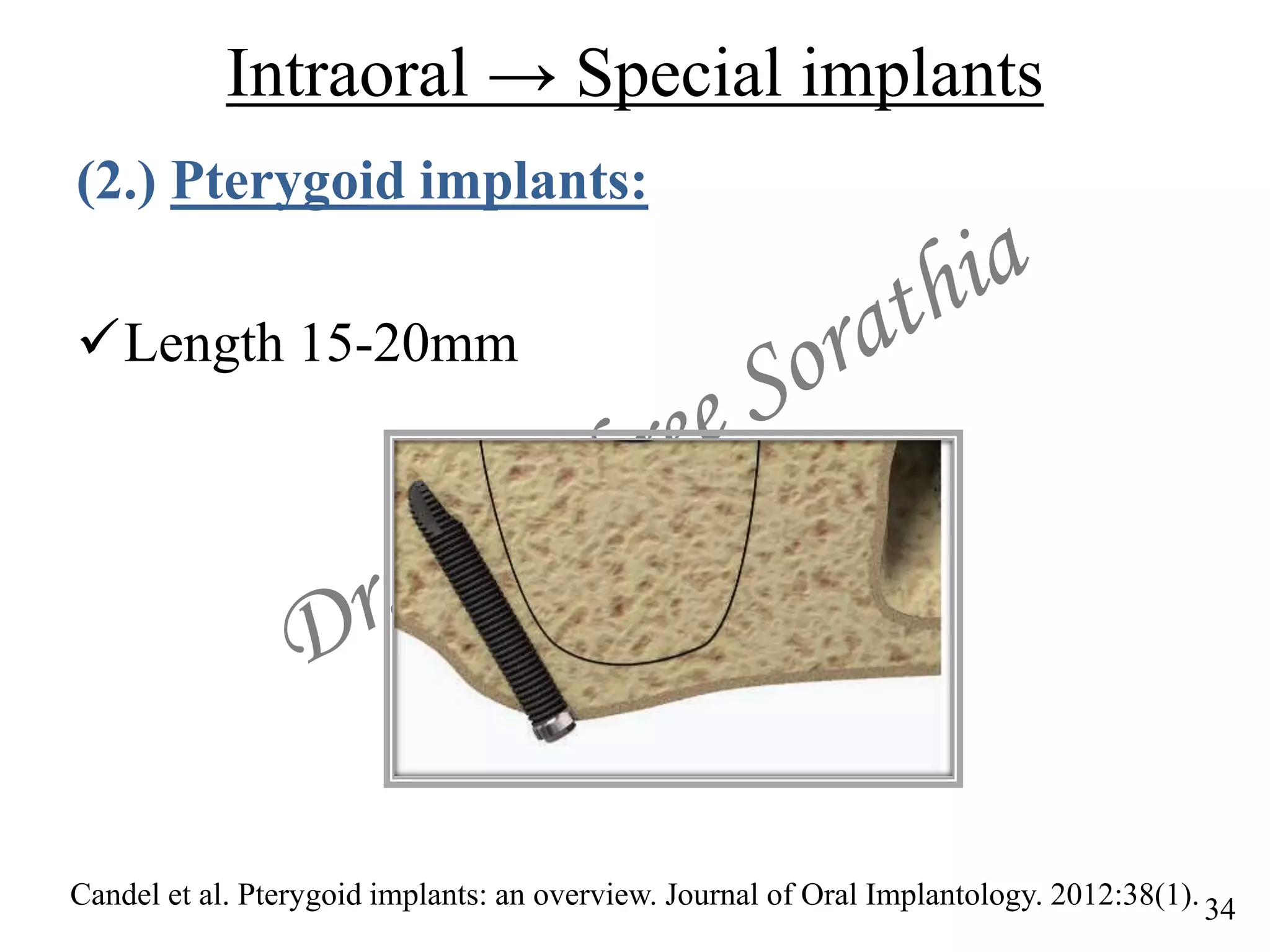 Classification and Types of Craniofacial Implants | PPTX