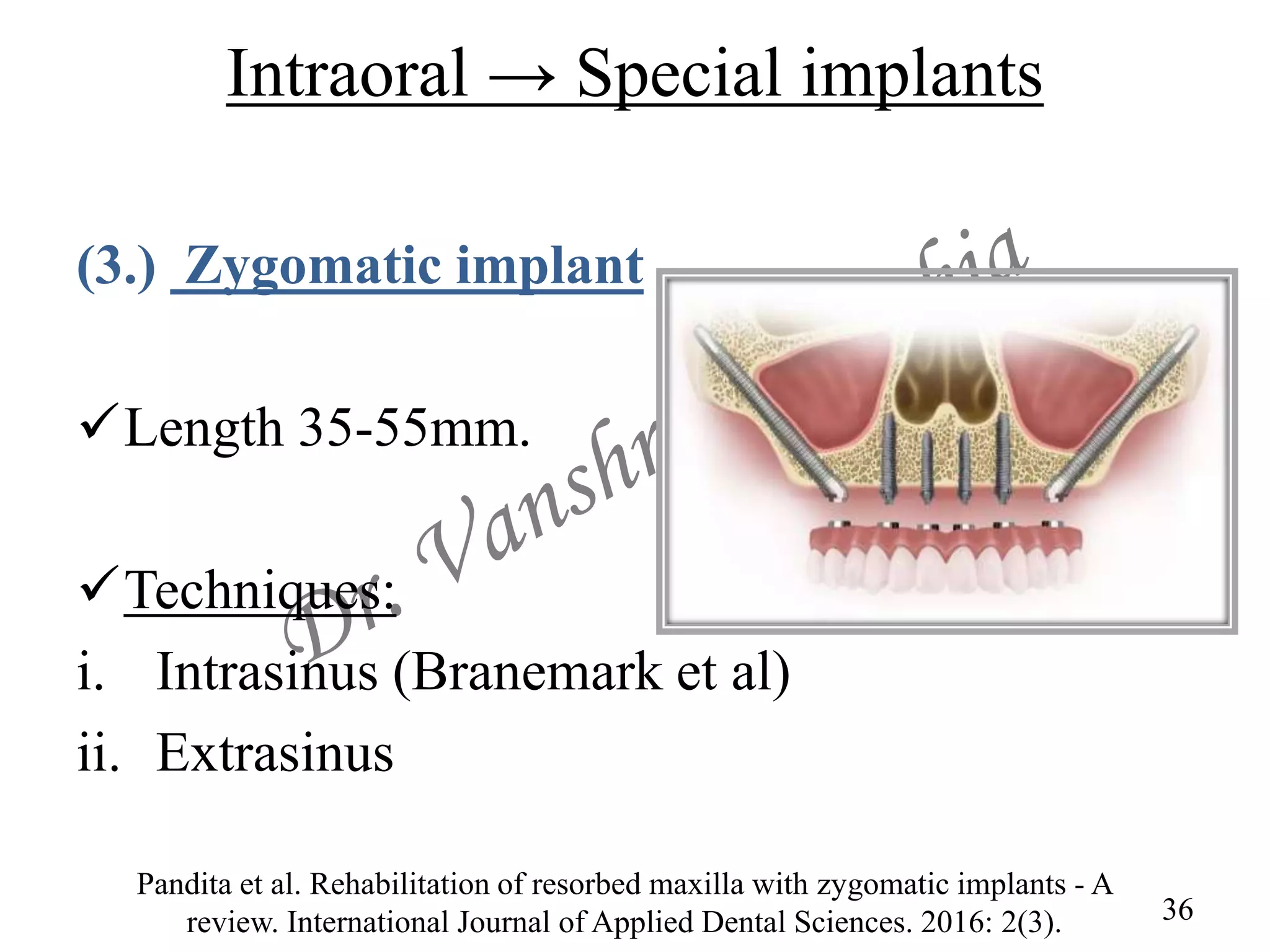 Classification and Types of Craniofacial Implants | PPTX